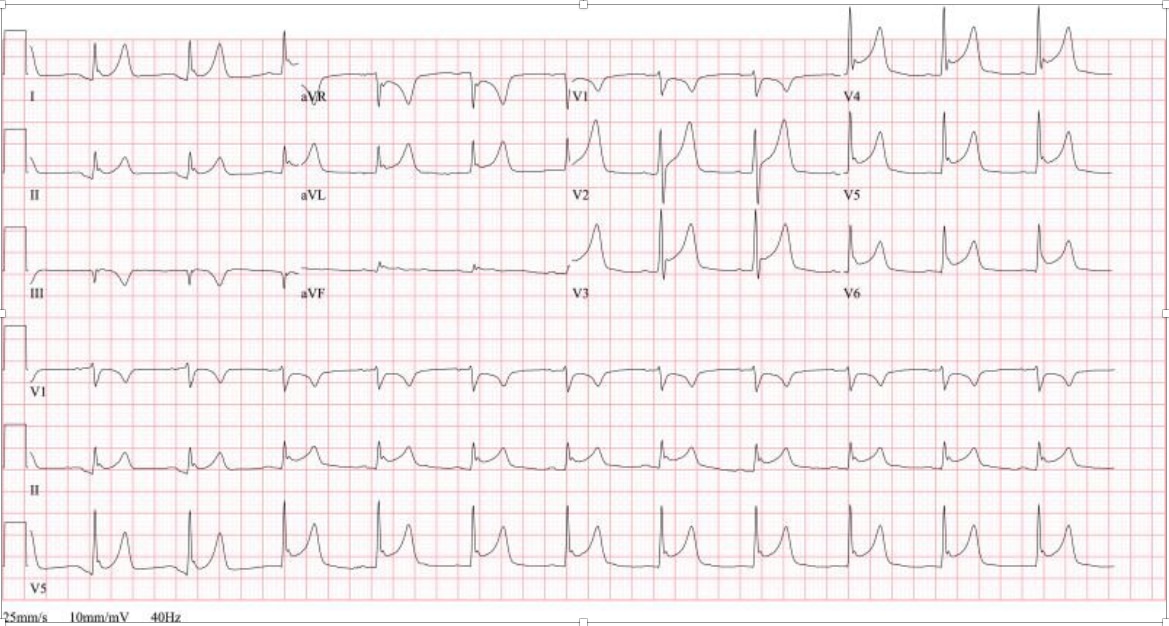 12-Lead EKG - My EMS ConEd